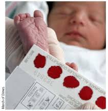 A simple step to reduce pain and blood loss for our babies | All Things ...