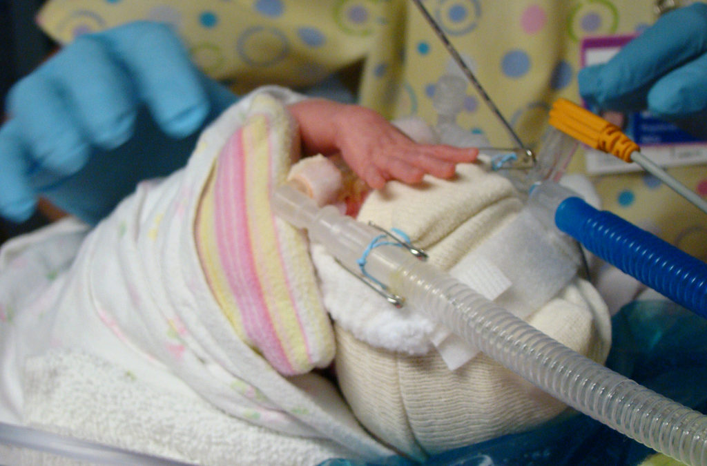 A Model For Reducing Parental Stress in the NICU. | All Things Neonatal