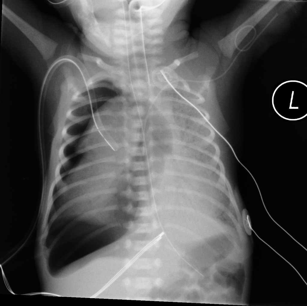 Parents Corner | All Things Neonatal